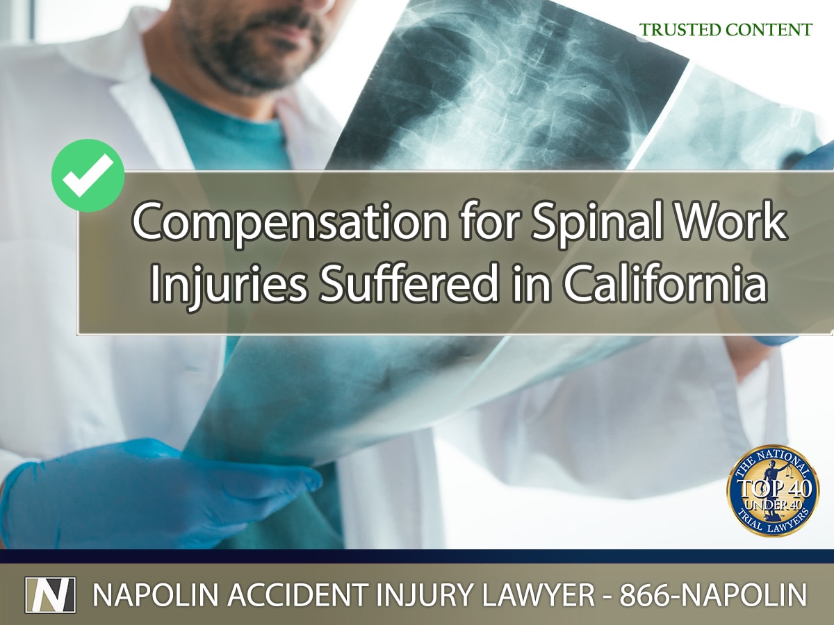 Compensation for Spinal Work Injuries Suffered in Ontario, California